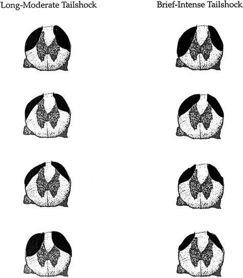 Representative Lesions Of The Dorsolateral Funiculus Download Scientific Diagram