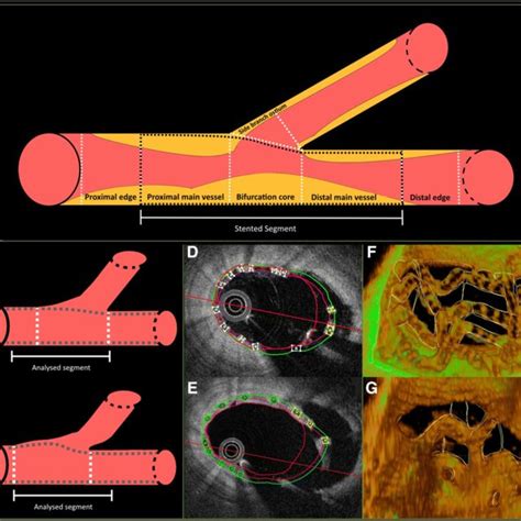 Segmental OCT Analysis A Segments In OCT Analysis B C The Download Scientific Diagram