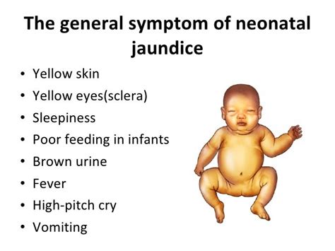 How Much Bilirubin Causes Jaundice In Newborns At Dorothy Hood Blog
