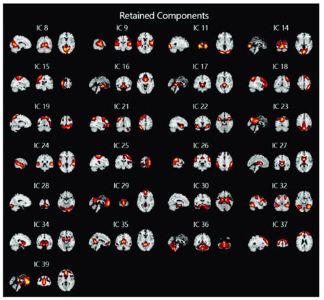 The Results Of Ica Of Fmri And Removal Of Noise And Artifacts After
