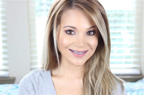 Adult Braces Month Update Managing Expectations