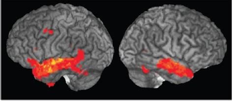 Talking Brains Intelligible Speech And Hierarchical Organization Of