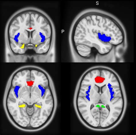 Resting State Eeg Source Analysis Identifies Distinct Neural Signature Associated With Impulse