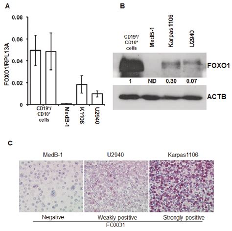 foxo1 expression differs in pmbl cell lines a foxo1 mrna expression