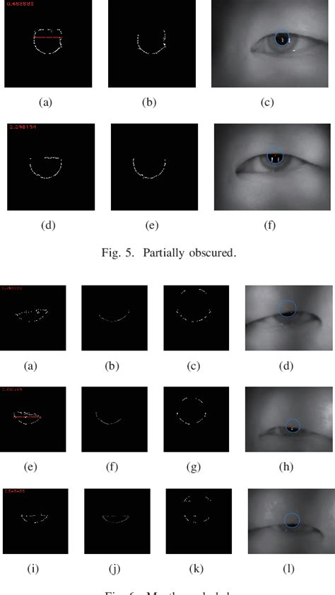Figure 1 From A Pupil Localization Method Based On Dual Threshold And