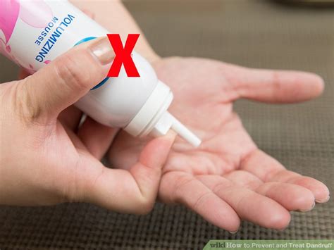Ways To Prevent And Treat Dandruff Wikihow