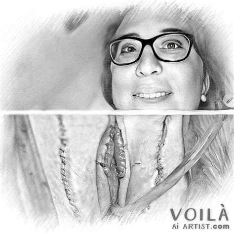 Post Operative Pic Rtransgendersurgeries