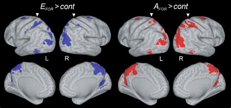 Figure 1 From The Neural Basis Of The Egocentric And Allocentric Spatial Frame Of Reference