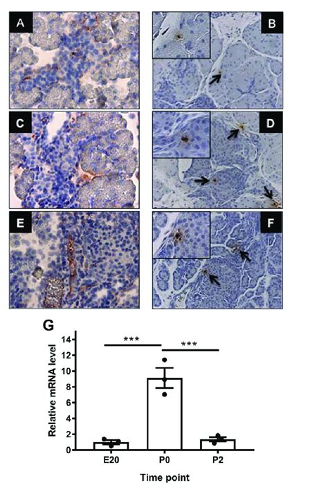 Expression And Cellular Localization Of Afp In Rat Pancreas Samples At