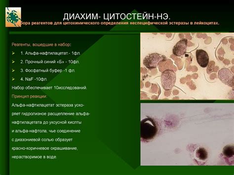 Диагностика заболеваний. Гематологический атлас - презентация онлайн