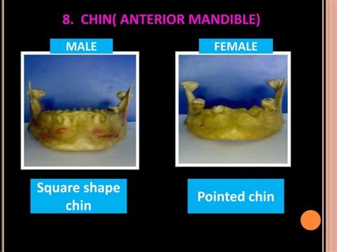 Sex Determination In Forensic PPTX