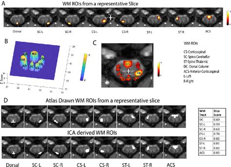 Figure 3 From Identification Of Synchronous Bold Signal Patterns In White Matter Of Primate
