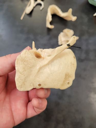 Temporal Bone Flashcards Quizlet