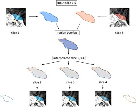 One Iteration In The Proposed Morphological Contour Interpolation