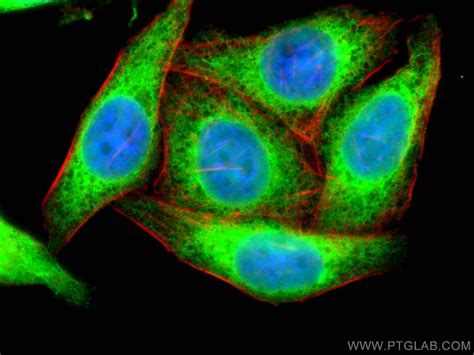 Calnexin Antibody 10427 2 Ap Proteintech