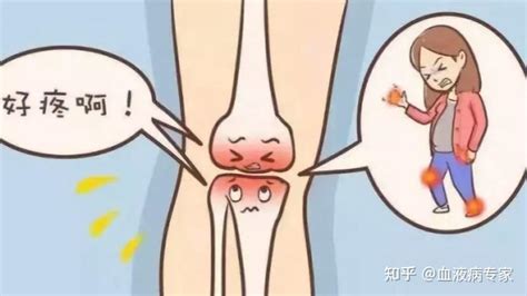 白血病并非毫无预兆前期身体会有5个表现暗示你 不要不当回事 知乎