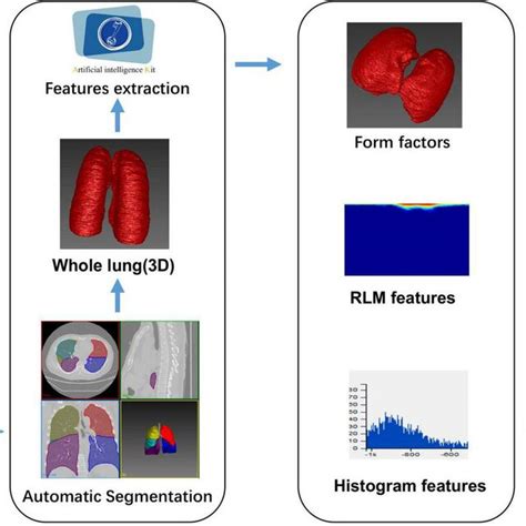 Flowchart Showing How The Radiomic Signature Was Developed Ct Download Scientific Diagram
