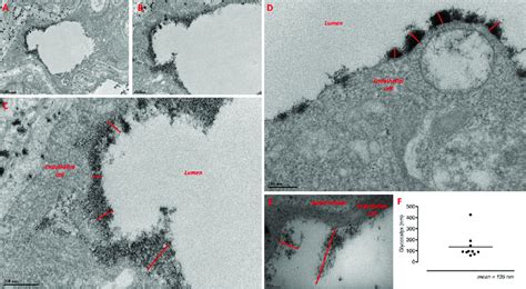 Endothelial Glycocalyx Structure In Human Lung Transmission Electron