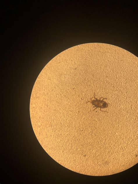 Identify This Microscope Image Of Bug Rwhatsthisbug