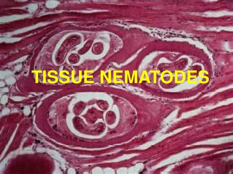 Ppt Tissue Nematodes Powerpoint Presentation Free Download Id297497