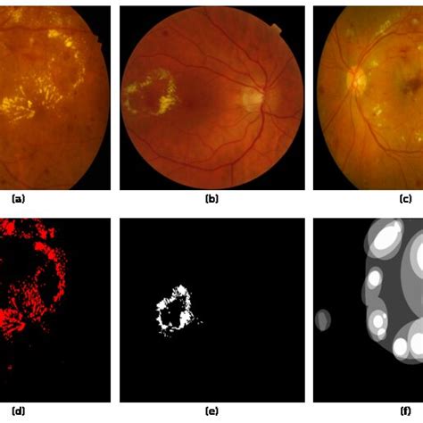 Image Samples Of The Three Different Datasets Used In The Proposed Download Scientific Diagram