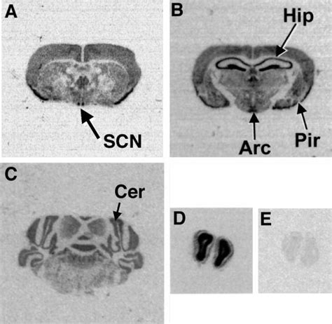 In Situ Hybridization Of Coronal Sections Through The Mouse Brain Shows Download Scientific