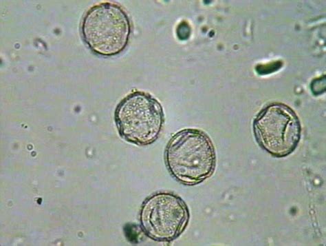 Fraxinus Excelsior Cells Microscope Image