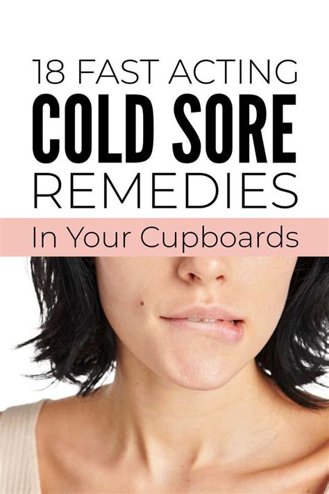 Cold Sores Artofit