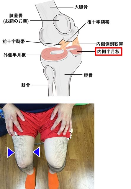 半月板損傷で衰えたももの筋肉を取り戻す！50代男性リハビリトレーニング 山梨県 甲州市 ジム【ラクエル】