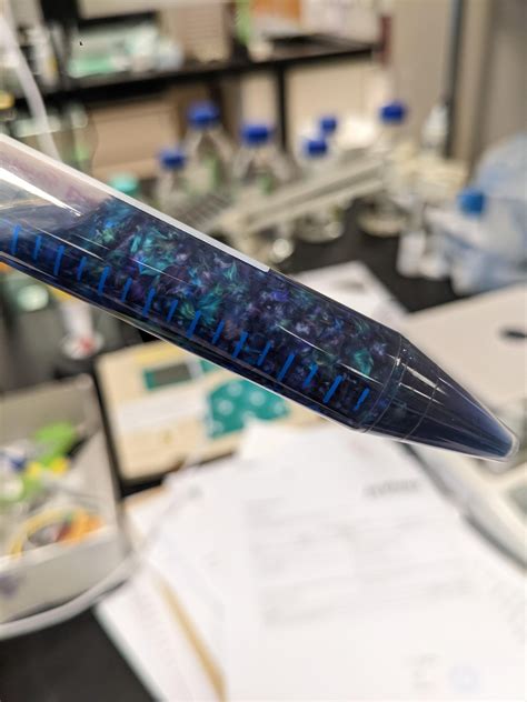 Loading Buffer Left In 4degc For 2 Years Rlabrats