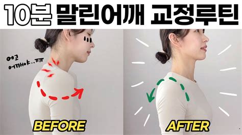 딱 10분 라운드숄더가 있다면 이 운동‘ 제발 하셔야 합니다 승모근통증 일자어깨 Youtube