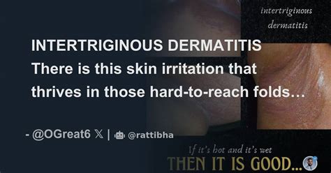 Intertriginous Dermatitis There Is This Skin Irritation That Thrives In Those Hard To Reach