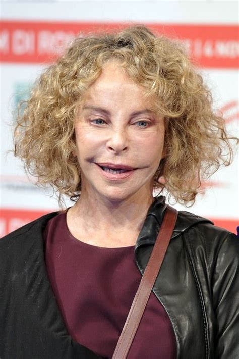 Они были красотками но увлечение пластикой лишило их красоты