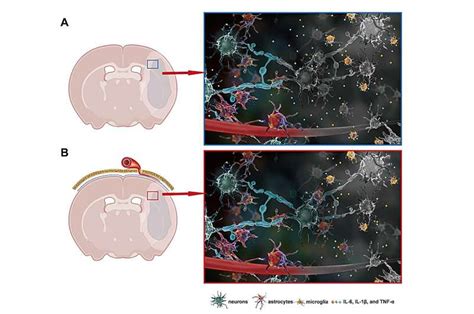 Novel Method For Treating Cerebral Ischemic Stroke Modulates Molecular