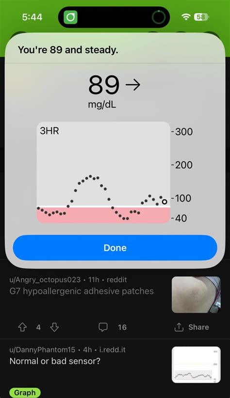 Expiration Dates R Dexcom
