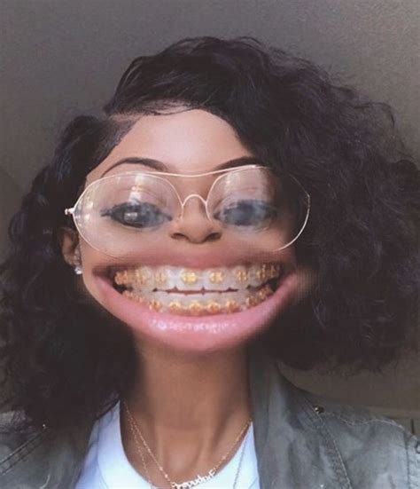 Vsco Weirdlyykayla Brace Face Braces Tips Cute Braces