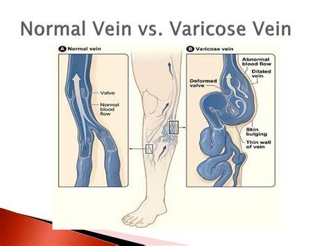 Ppt Understanding The Anatomy Of Blood Vessels Powerpoint