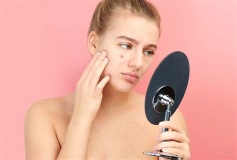 What Causes Pimple Redness And How To Reduce It Emedihealth