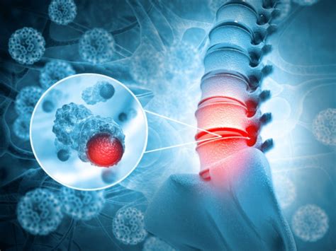 Actriz Renata Del Castillo Es Hospitalizada De Emergencia Por Grave Tumor