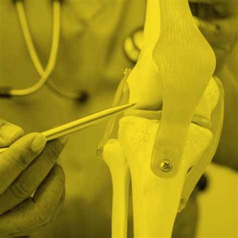 Manipulation Under Anesthesia After Tkr Surgery