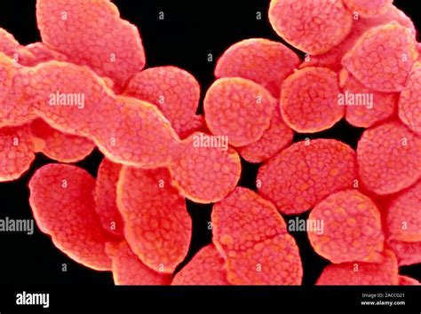 Resistant Streptococcus Strain Coloured Scanning Electron Micrograph Of Dividing Streptococcus