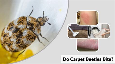 Do Carpet Beetles Bite A Complete Rash And Safety Guide