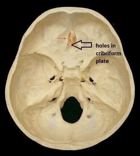 Olfactory Foramina Location
