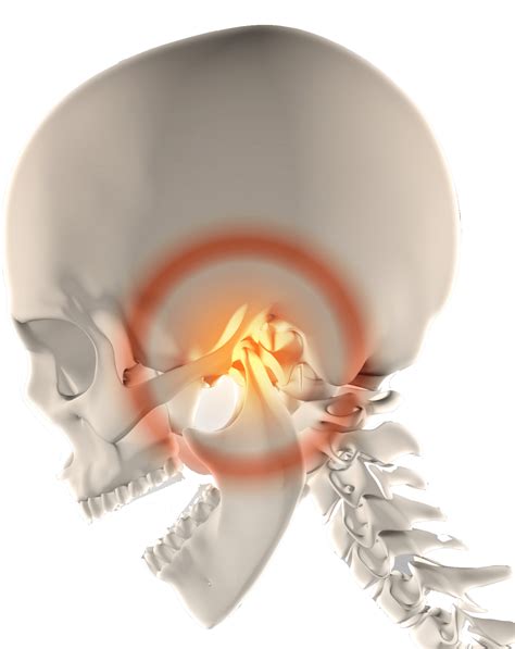 TMJ Symptoms Treatment Florence SC Jaw Pain Darlington