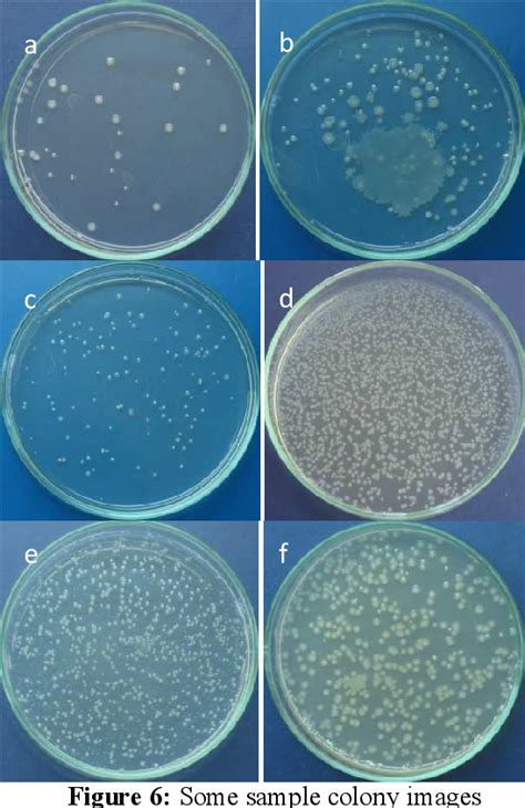 Figure 6 From An Image Processing Based Automated Bacteria Colony Counter Semantic Scholar