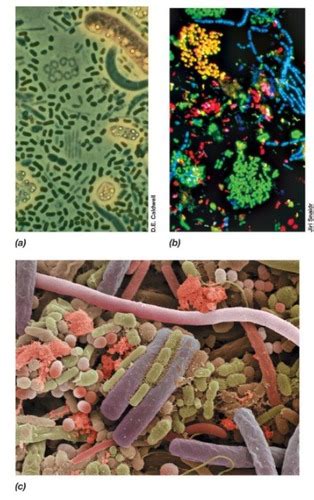 Chapter The Microbial World Flashcards Quizlet