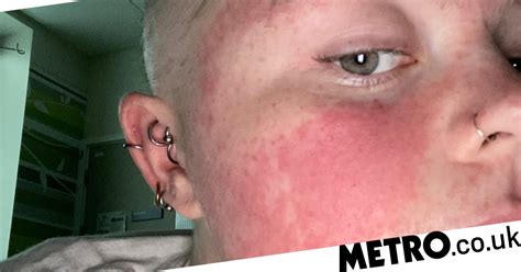 When Cancer Killed My Sex Drive At 22 I Became Proudly Celibate