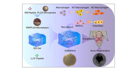 Microspheregel Composite System With Mesenchymal Stem Cell Recruitment