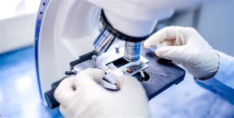 რა უნდა ვიცოდეთ ჯილეხის შესახებ ამბროლაურის ხმა