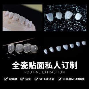 同康3D美牙全瓷贴片美白牙贴玻璃瓷牙齿贴面义获嘉蓝瓷琥珀瓷教学 阿里巴巴